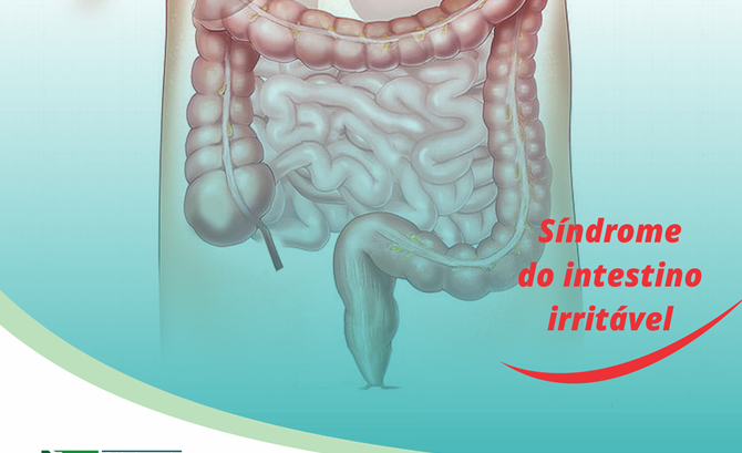 síndrome do intestino irritável: você sabe o que é?
